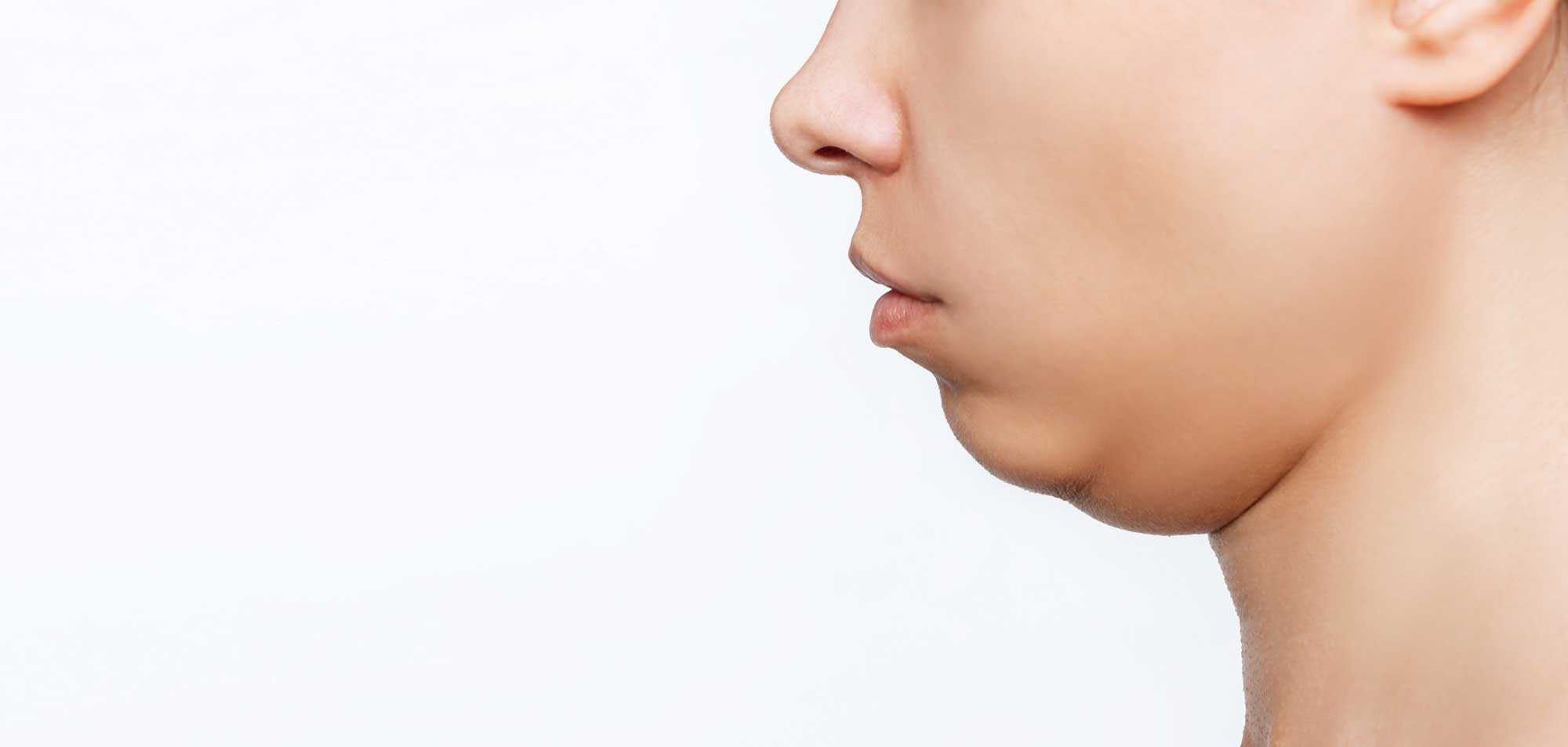 La retrognatia mandibular y su tratamiento - Clinica Ferreras